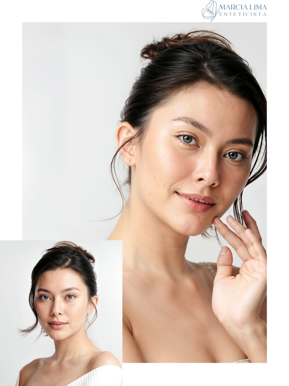 Tratamento Mesoterapia – Marcia Lima Esteticista